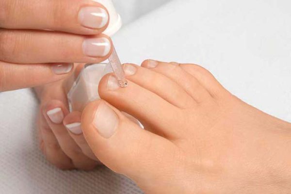 How to Get Rid of Toenail Fungus Fast and Effectively