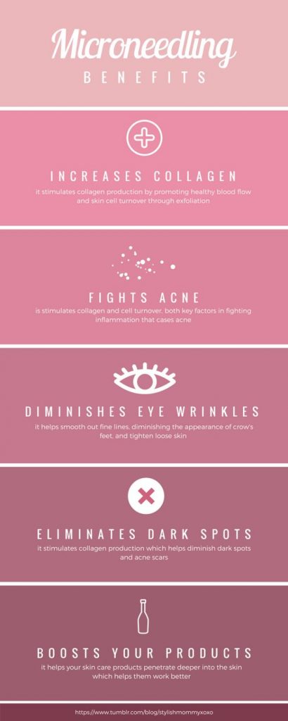 Understanding How Microneedling Works and What to Expect