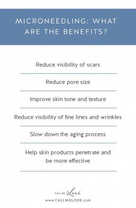 Understanding How Microneedling Works and What to Expect