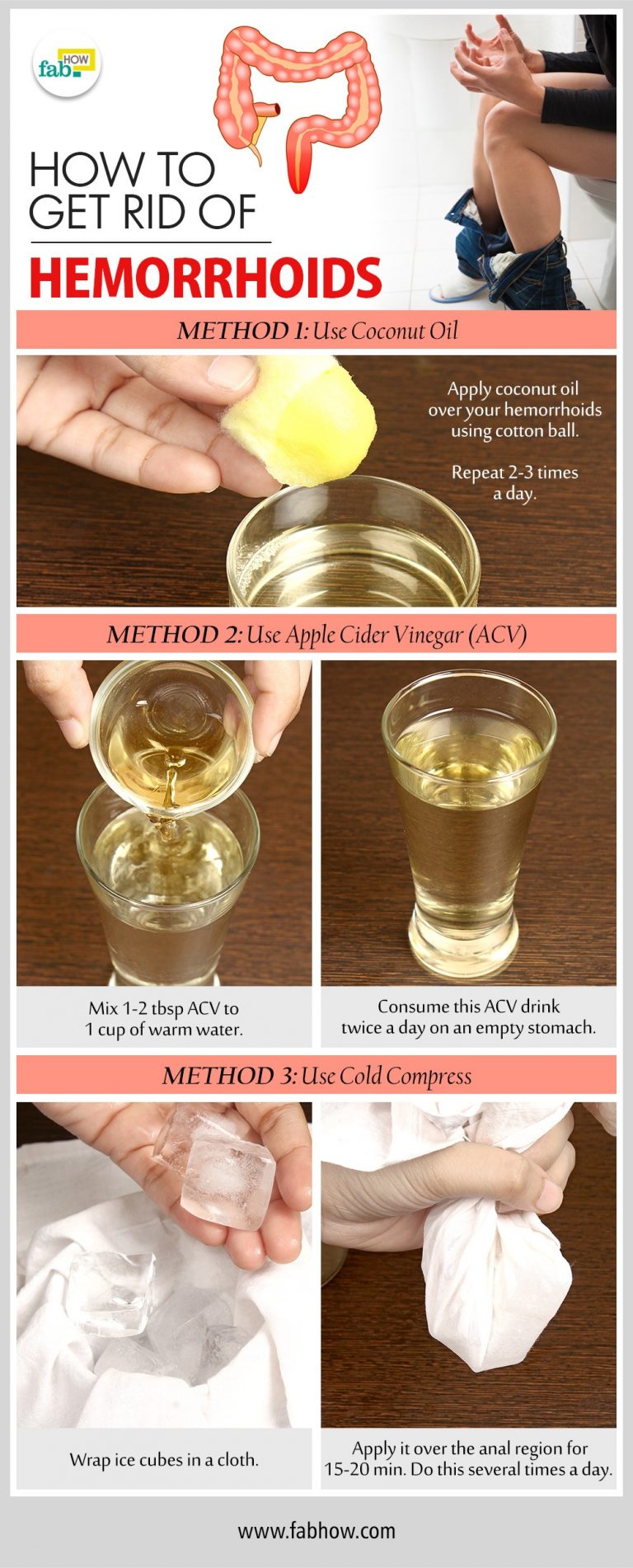 How to Treat Hemorrhoids - Top Hemorrhoid Treatment