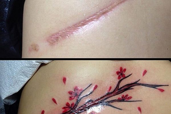Common Tattoo Side Effects To Check Out