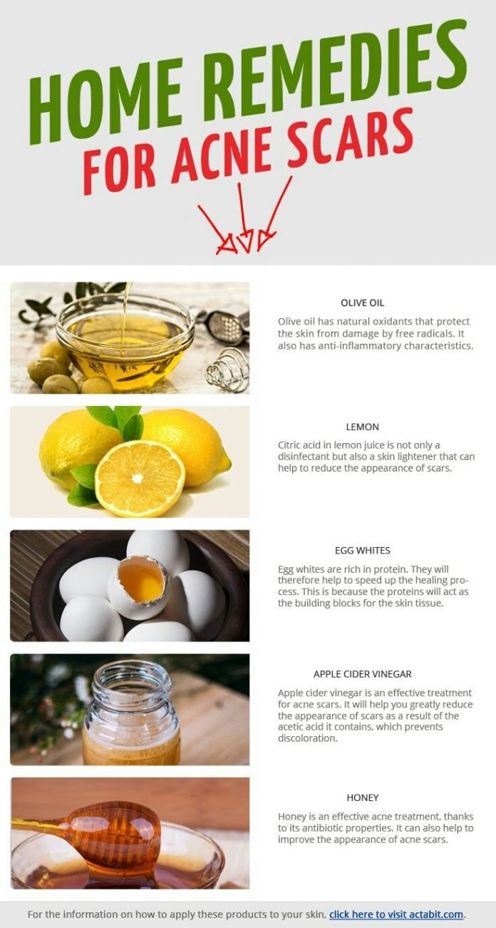 4 Natural Remedies for Acne That Will Clean Your Skin