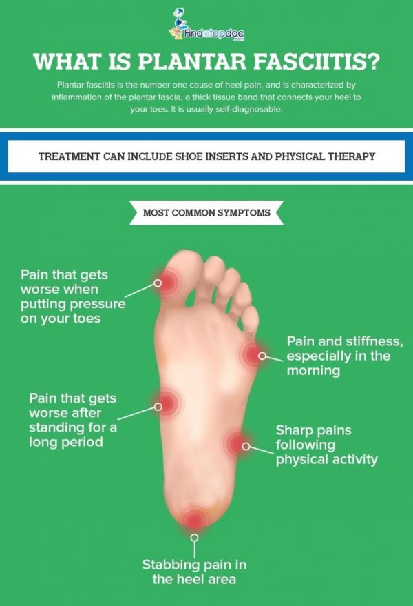 You Need to Know About Plantar Fasciitis - Women Fitness Magazine